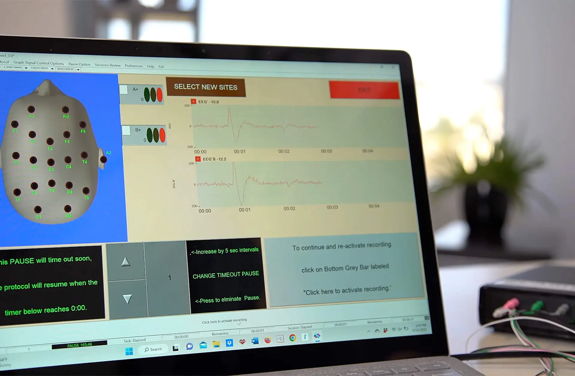 CLARITY Direct Neurofeedback: Enhance Your Clinical Workflow